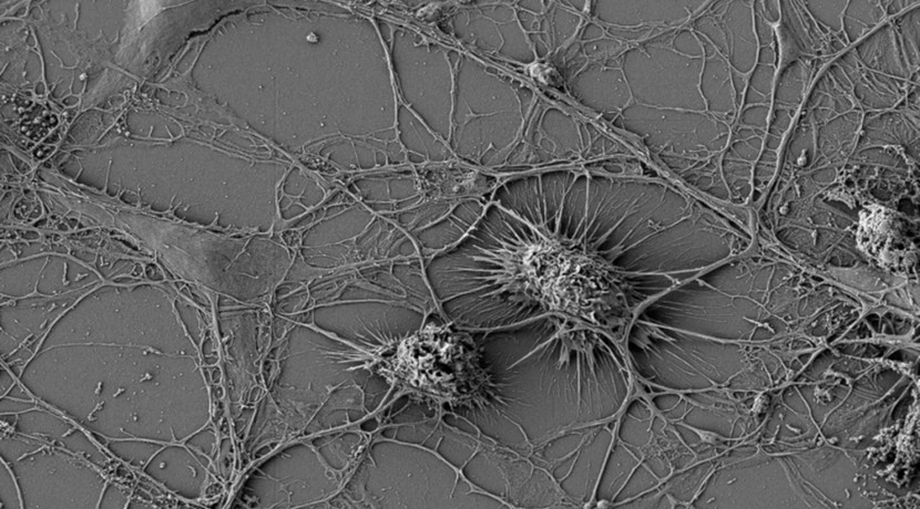 Tiny “tunnels” within the mind shield nerve cells. - World Today Journal