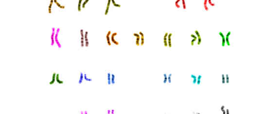 Genie und Wahnsinn besitzen die selbe genetische Grundlage