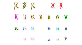 Genie und Wahnsinn besitzen die selbe genetische Grundlage